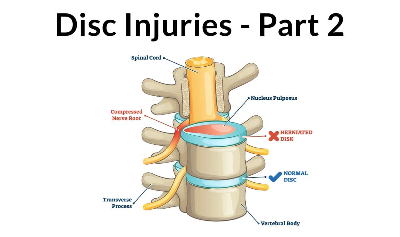 Disc Injuries (Part 2) - Element Chiropractic